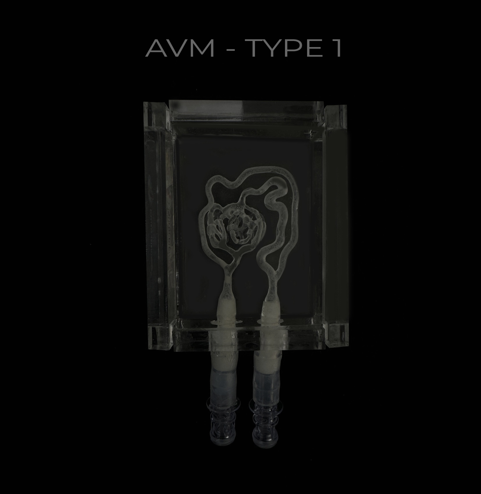 AVM Embolization Model | AVM Treatment & Surgical Training